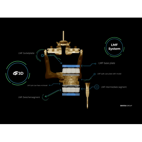 LMF System LMF Plattenset / Zwischensegmente